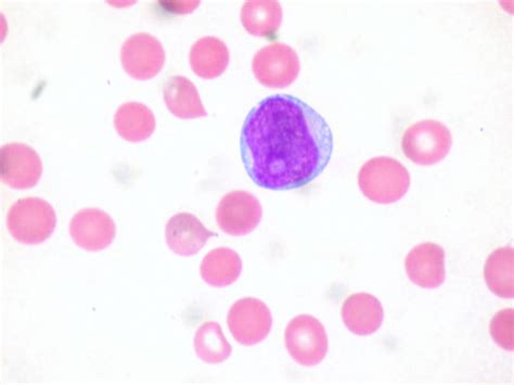 Maturation Sequence Of Granulocyte Flashcards Quizlet