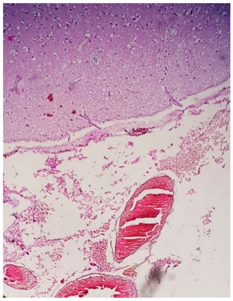 Pregnant Mucus Plug Microscope