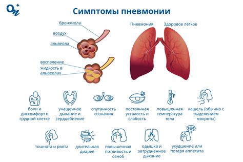 Что такое пневмония — блог медицинского центра ОН Клиник