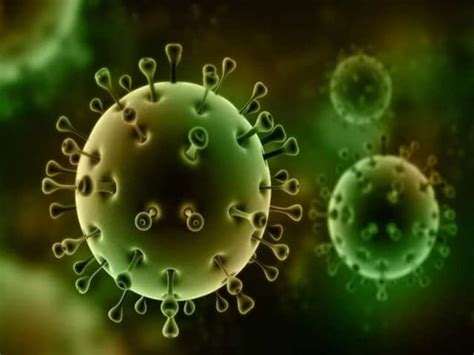 Seminar Vasculitiespptx