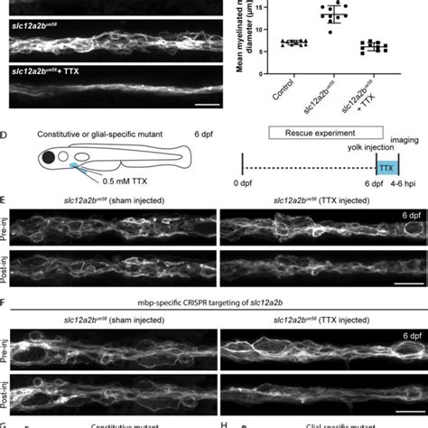 Periaxonal Space Swelling Axonal Enlargement And Myelin Outfoldings