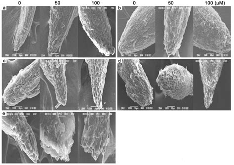 Scanning Electron Microscopic Photographs Of Root Tip Architecture Scanning Electron Microscopic Photographs Of Root Tip Architecture