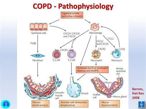 Pathophysiology Of Copd Flow Chart Asthma Pathophysiology N