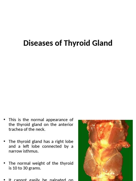 Diseases Of Thyroid Gland Pdf Thyroid Hyperthyroidism