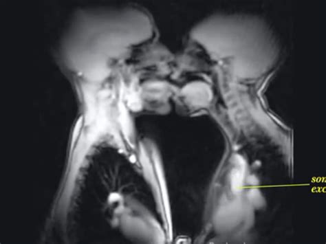 So Sieht Sex Im Mrt Aus Volat