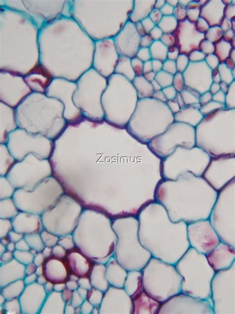 Water Lily Nymphaea Stem Under The Microscope Iphone Case For Sale