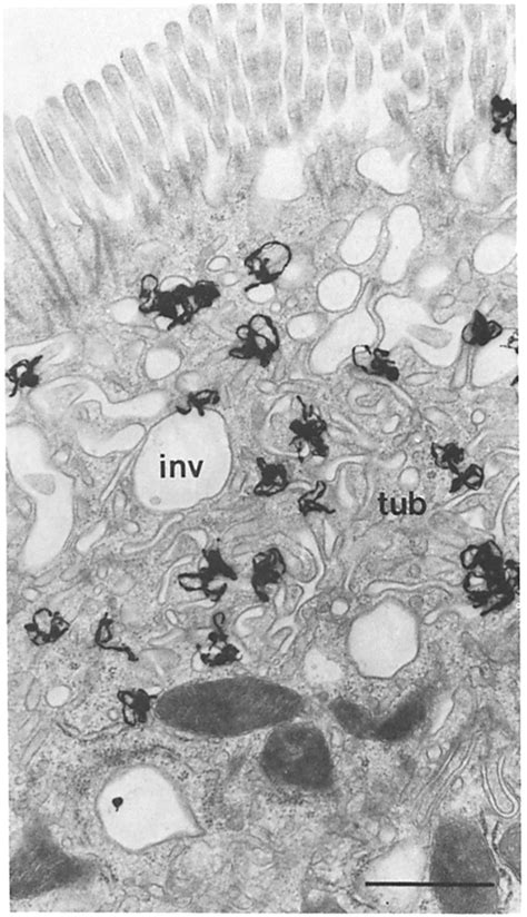 Em Autoradiograph Of The Apical Region Of An Ileal Absorptive Cell 1 H
