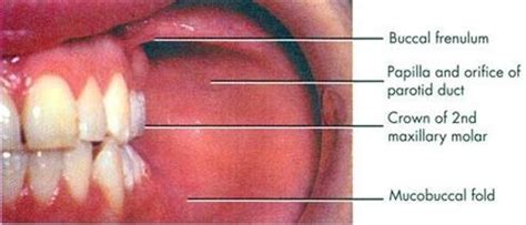 4 02 Buccal Vestibule Infections Flashcards Quizlet