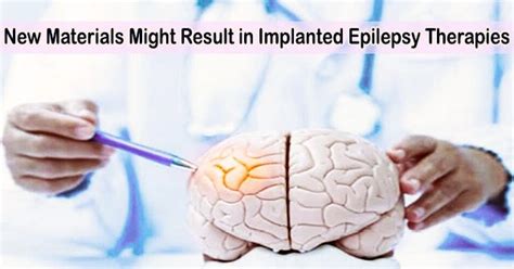 New Materials Might Result In Implanted Epilepsy Therapies Assignment