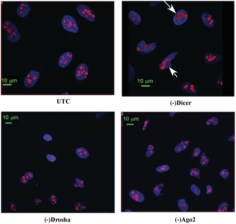 Cells Lacking Dicer Exhibit Altered Nucleolar Structure Indirect