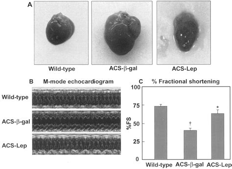 Hyperleptinemia Hypertension