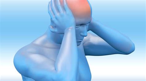 Brain Aneurysm Causes Symptoms Diagnosis And Treatment Medline