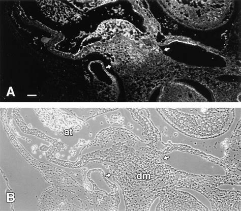 Intracardiac Mesenchyme Derived From The Dorsal Mesocardium Acquires