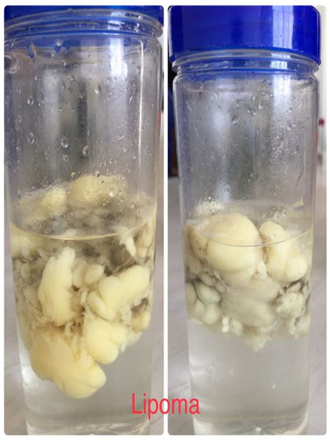 Surgery Specimen Pdf