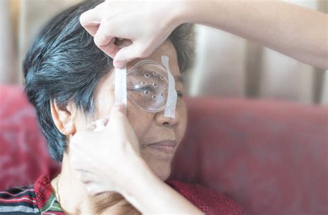 Best Way To Remove Eye Makeup After Cataract Surgery Saubhaya Makeup