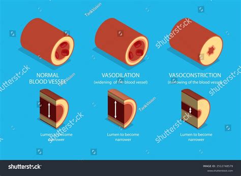 3d Isometric Flat Vector Illustration Vasoconstriction Stock Vector