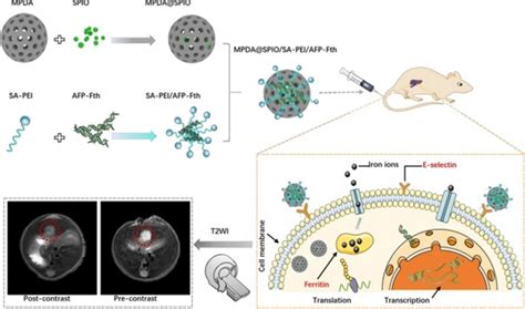 Recent Developments In Mesoporous Polydopamine Derived Nanoplatforms