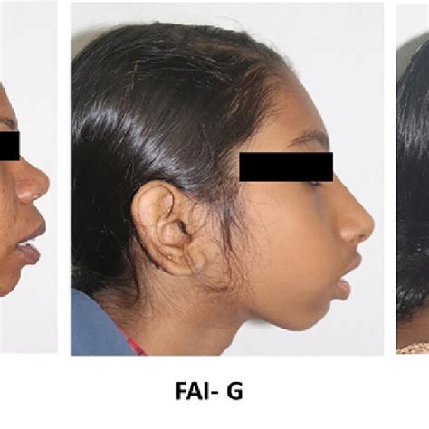The Adapted Version Of Pidaq Questionnaire Download Scientific Diagram