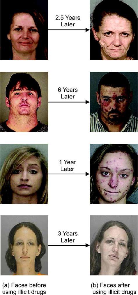 Red Face Drugs At Richard Sandoval Blog