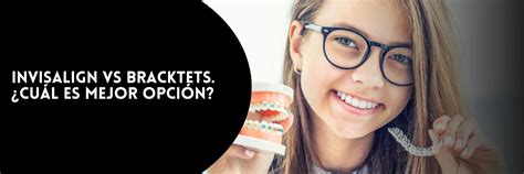 Invisalign Vs Brackets ¿qué Opción Te Conviene Más