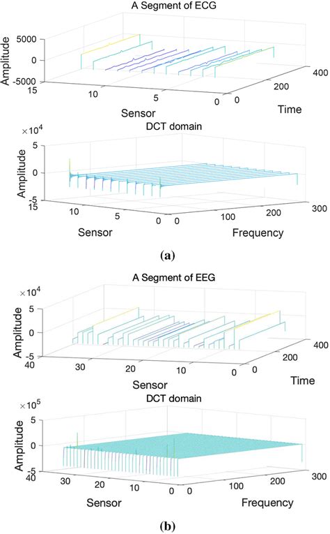 A Ecg And Its Dct B Eeg And Its Dct Download Scientific Diagram
