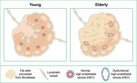 How Fat Takes Over The Lymph Nodes As We Age