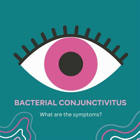 Opticare Opticians On Linkedin Conjunctivitis Opticareni Eyecare Wecare Opticare Eyehealth…