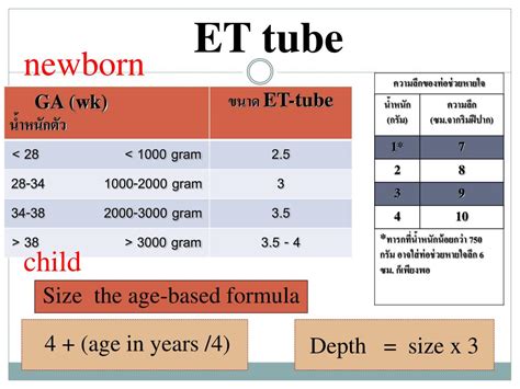 Ppt Transportation In Critical Pediatric Patient Powerpoint