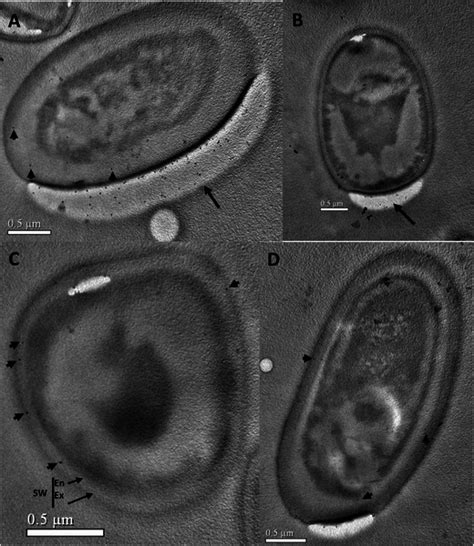 Immunoelectron Microscopy Plos One