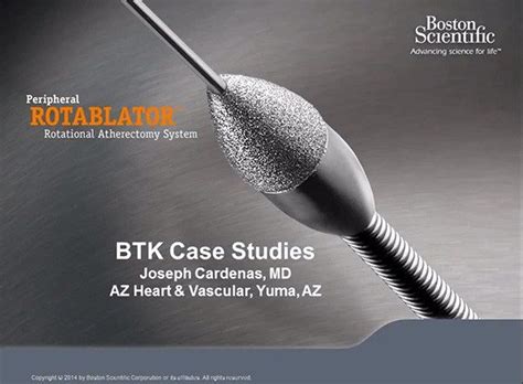 Peripheral Rotablator™ Rotational Atherectomy System Boston Scientific