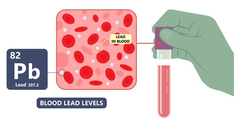 Is Lead Paint The Most Common Cause Of Lead Poisoning Mkj Construction