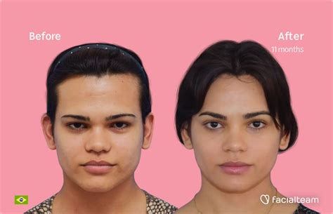 Become Your True Self Safely At Facialteam