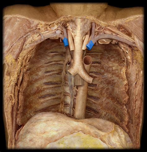Vein Lab Flashcards Quizlet