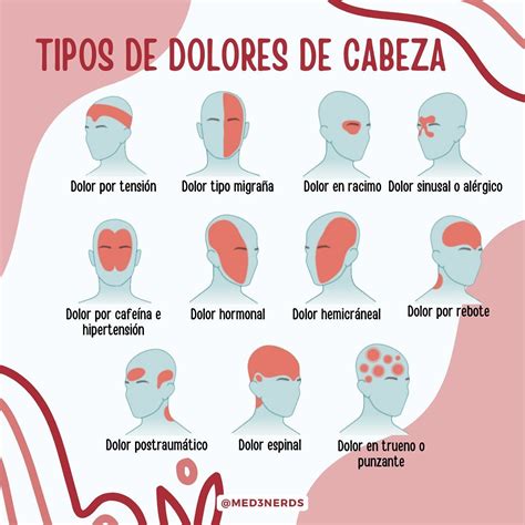 Diferentes Tipos De Dolores De Cabeza Dolor De Cabeza Shecares