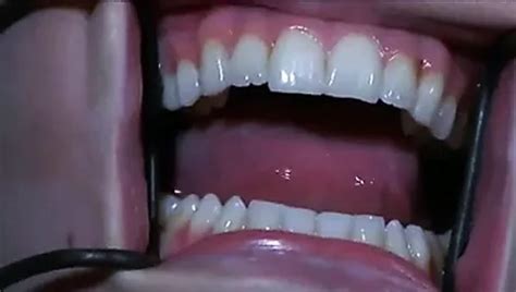 Insex Verzweigung Xhamster Insex Verzweigung Xhamster