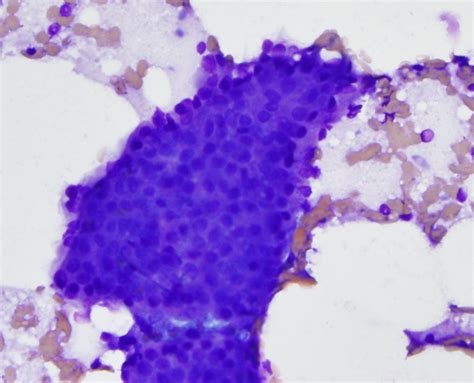 Differential Stains For Cytology
