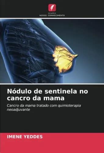 Nodulo De Sentinela No Cancro Da Mama Cancro Da Mama Tratad