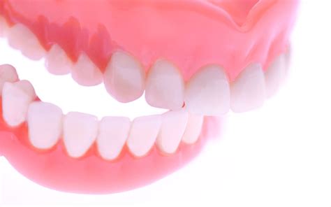 March 9 Is National False Teeth Day Choose Dental Implants