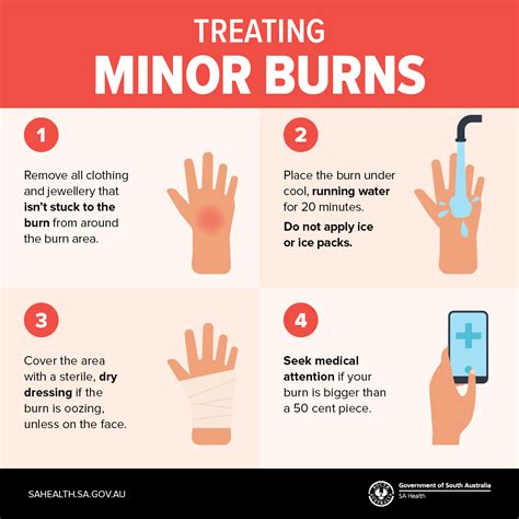 Initial First Aid Treatment For Minor Burns At Zara Khull Blog