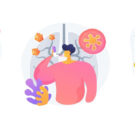 Socul Anafilactic Perspective Multidisciplinare Clubul Regal