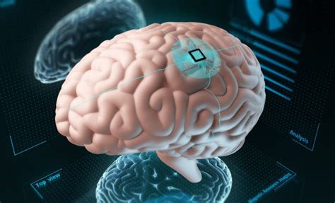 From Concussion To Alzheimers Mini Brain Unlocks Time Sensitive Link