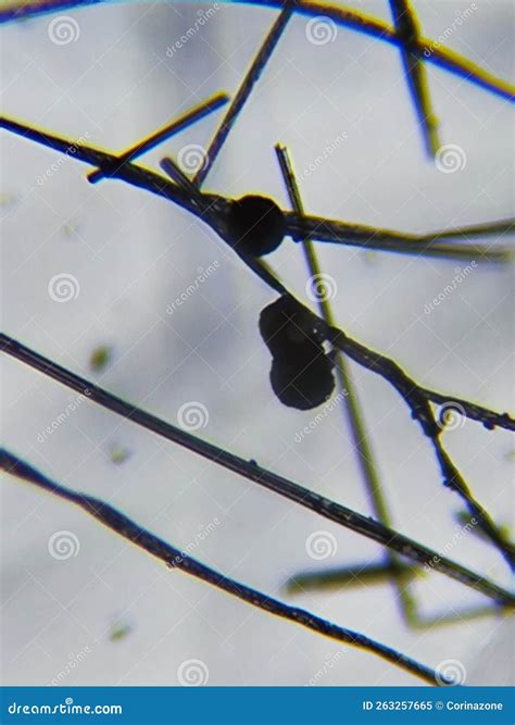Aspergillus Genus Mold Under The Microscope Stock Image Image Of