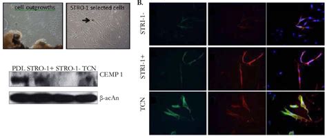 Stro 1 Selected Periodontal Ligament Pdl Cells A Phase Contrast Download Scientific Diagram