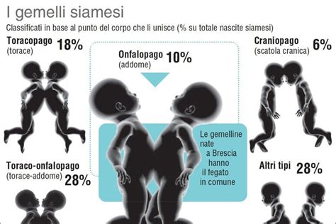 Schema Gemelli Siamesi