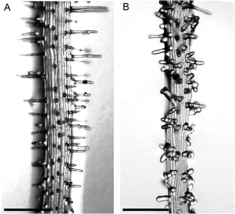 Ros And Scn1 Localization In Root Hairs Nbt Staining Of A Wild Download Scientific Diagram