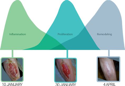 Polymem In Action Polymem Dressings