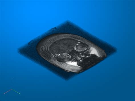 Imcrop3 Crop 3 D Image Matlab