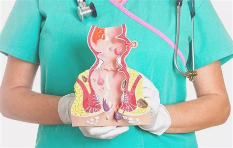 Modified Ligation Procedure Or Stapled Haemorrhoidectomy Which Is