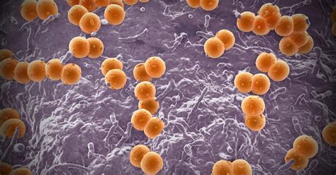 What Is Meningococcal Disease Symptoms To Know As Cdc Warns Of Spike In Bacterial Infection