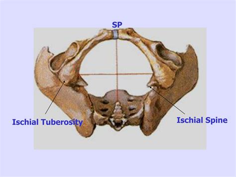 Ppt Bony Pelvis And Fetal Skull Dr Manal Behery 2014 Powerpoint